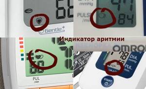 Почему тонометр «врёт»?: прогноз, лечение, симптомы в международной ...